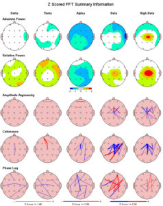 QEEG Brain Mapping – Jeannine Lemare Calaba Psy. D., BCN, Qeeg-D